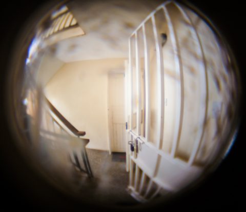 Peripheral Vision Loss: Causes, Diagnosis, & Treatment Options